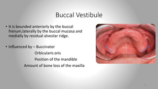 Anatomical landmarks of maxilla | PPTX