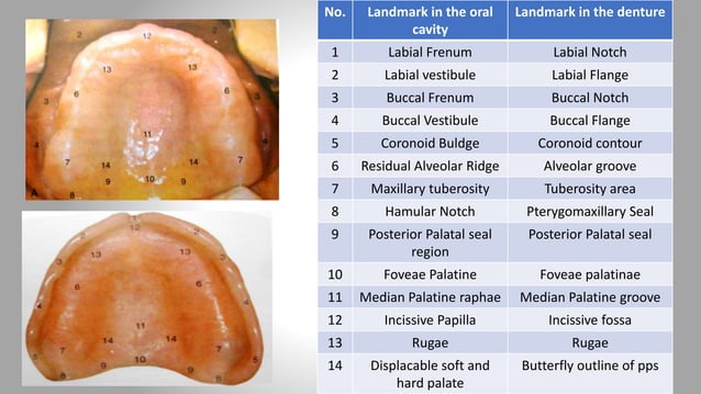 Anatomical landmarks of maxilla | PPT