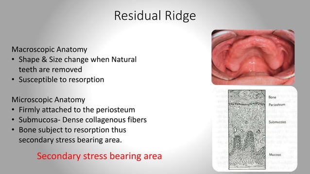 Anatomical landmarks of maxilla | PPT