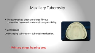 Fibrous Maxillary Tuberosity