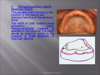 Anatomical landmarks of maxilla /certified fixed orthodontic courses by ...