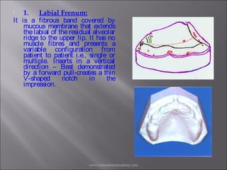 Anatomical landmarks of maxilla /certified fixed orthodontic courses by ...