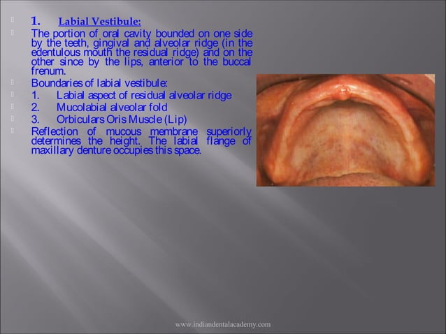 Anatomical landmarks of maxilla /certified fixed orthodontic courses…