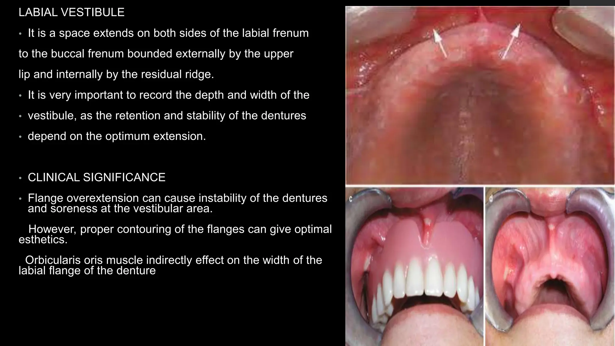 ANATOMICAL LANDMARKS OF MAXILLA AND MANDIBLE.pptx
