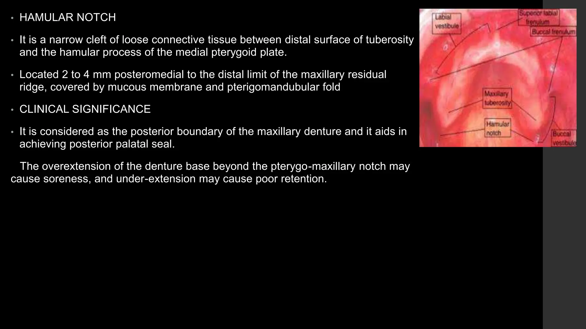 ANATOMICAL LANDMARKS OF MAXILLA AND MANDIBLE.pptx
