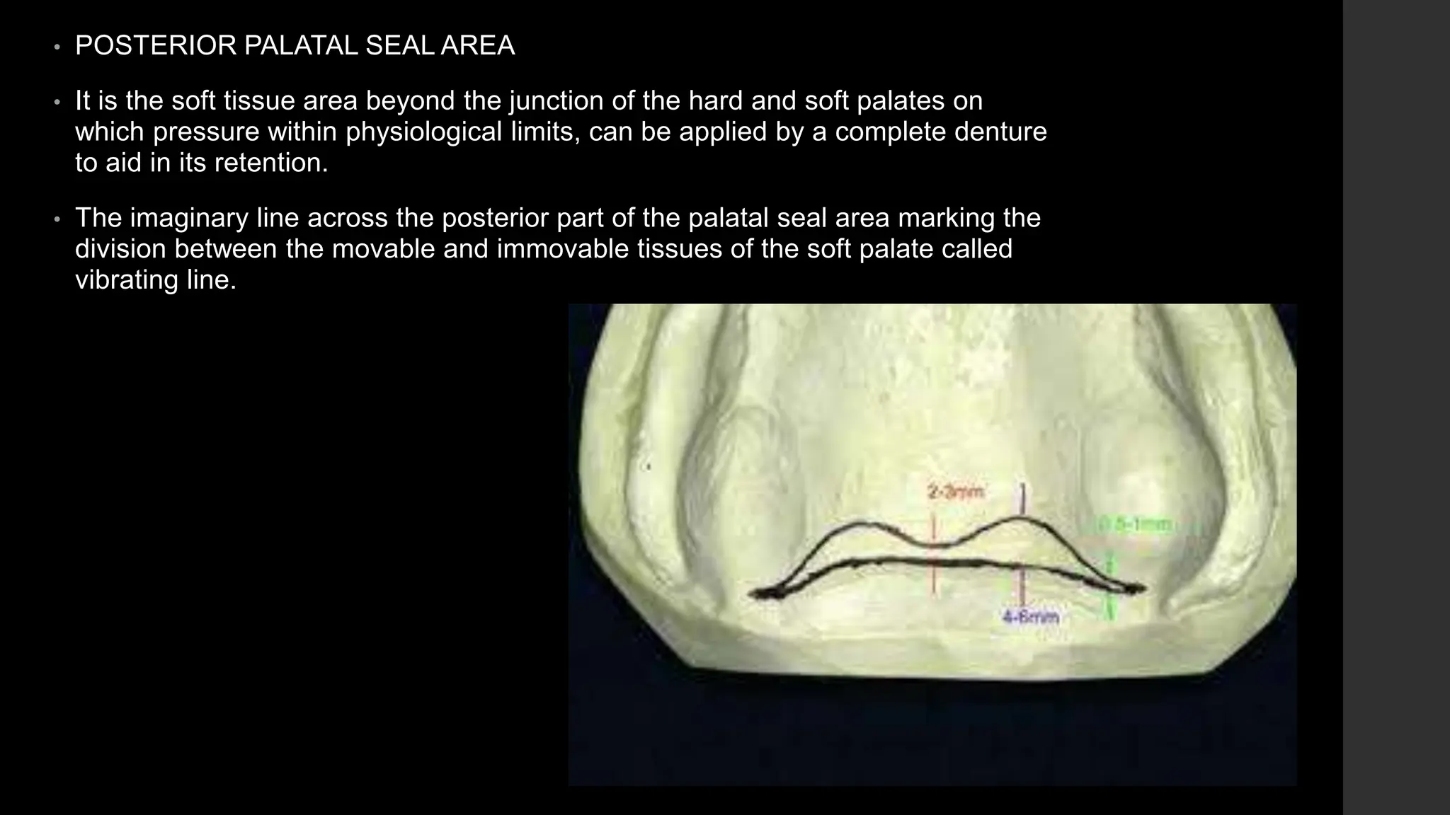 ANATOMICAL LANDMARKS OF MAXILLA AND MANDIBLE.pptx
