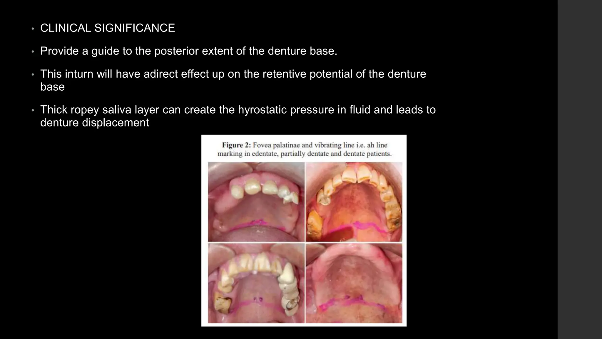 ANATOMICAL LANDMARKS OF MAXILLA AND MANDIBLE.pptx