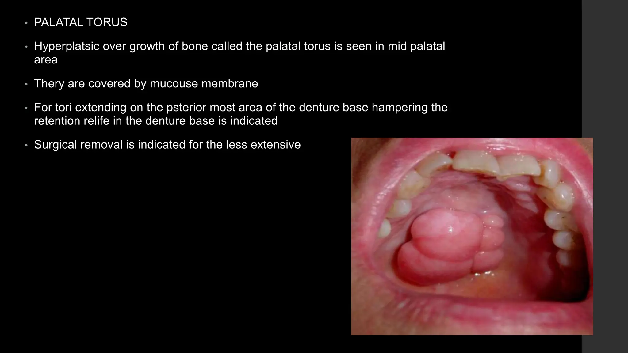 ANATOMICAL LANDMARKS OF MAXILLA AND MANDIBLE.pptx
