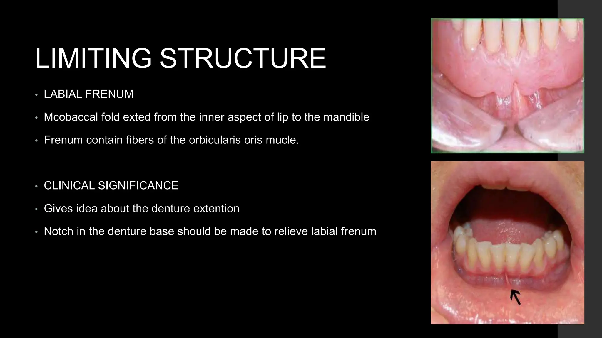 ANATOMICAL LANDMARKS OF MAXILLA AND MANDIBLE.pptx