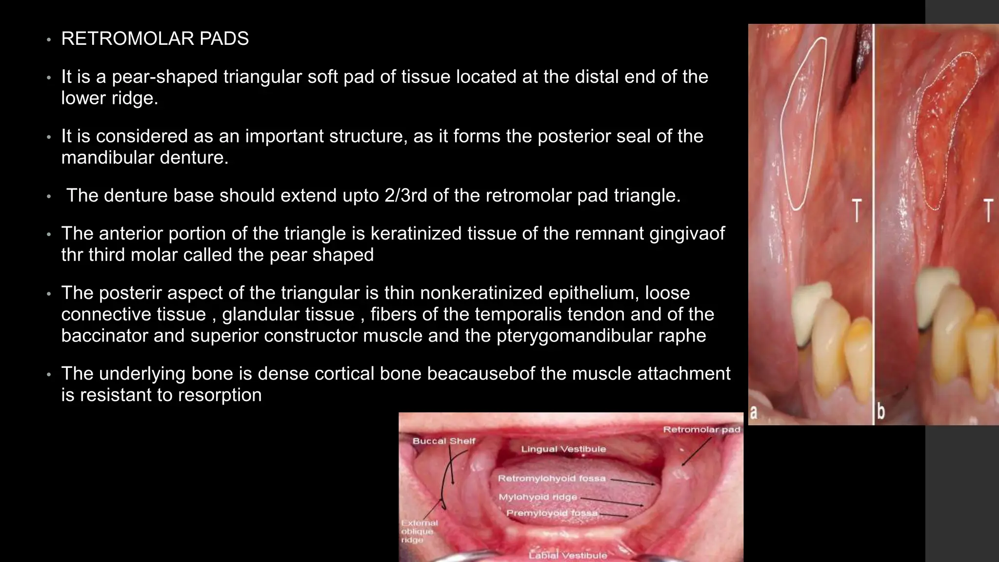ANATOMICAL LANDMARKS OF MAXILLA AND MANDIBLE.pptx