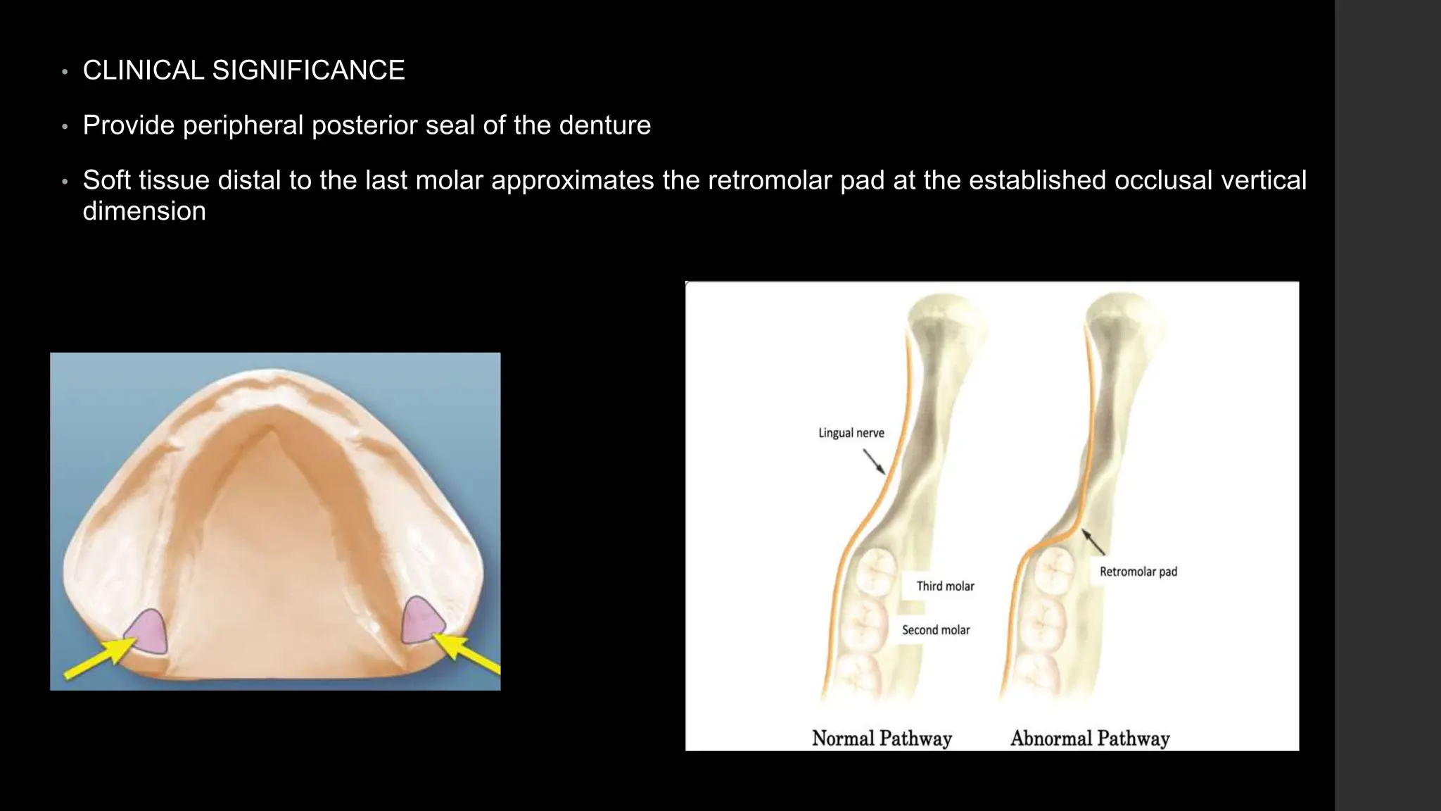 ANATOMICAL LANDMARKS OF MAXILLA AND MANDIBLE.pptx