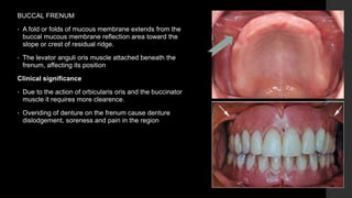 ANATOMICAL LANDMARKS OF MAXILLA AND MANDIBLE.pptx
