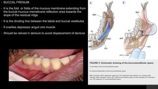 ANATOMICAL LANDMARKS OF MAXILLA AND MANDIBLE.pptx