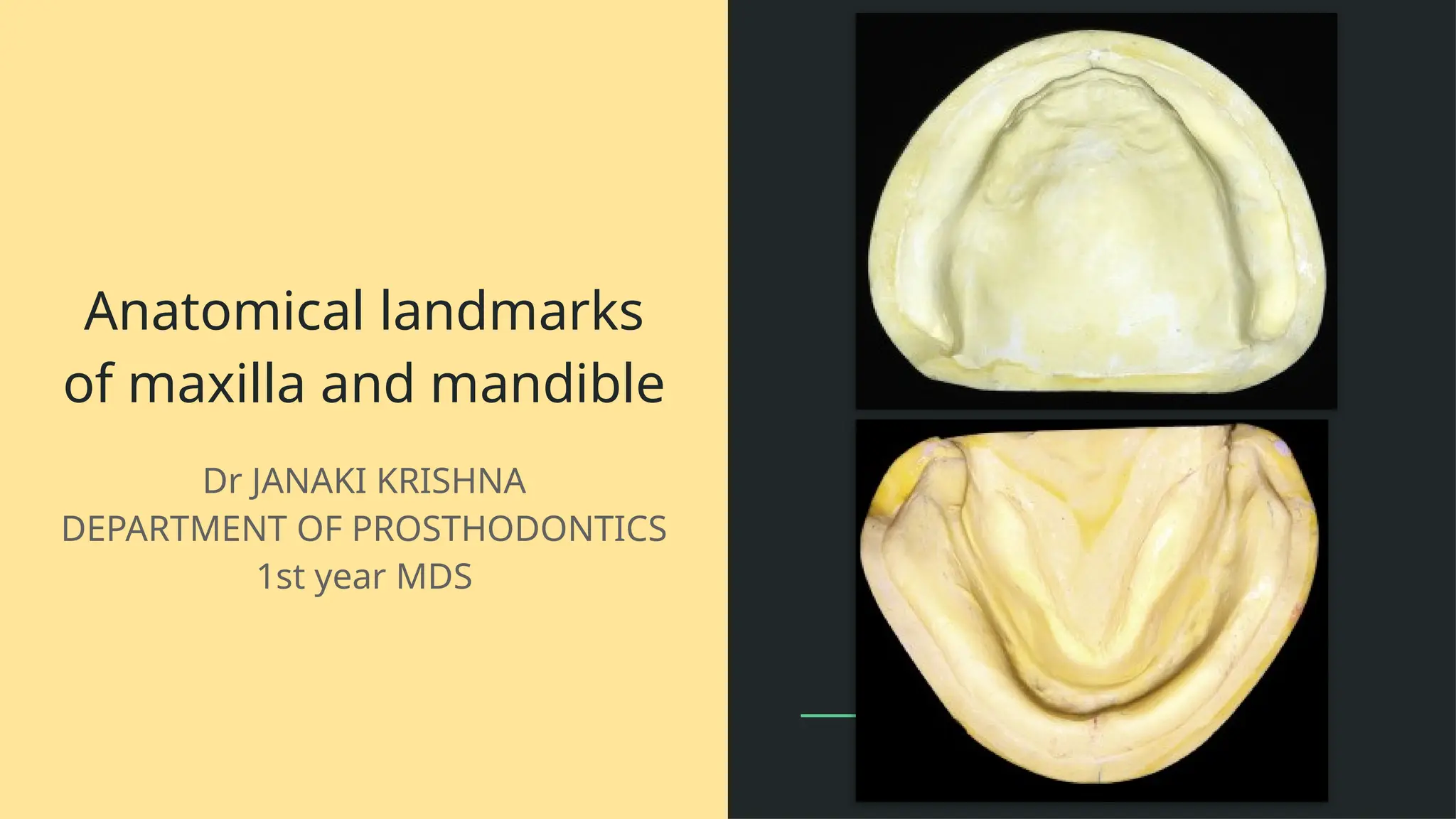 Anatomical landmarks of maxilla and mandible.pptx