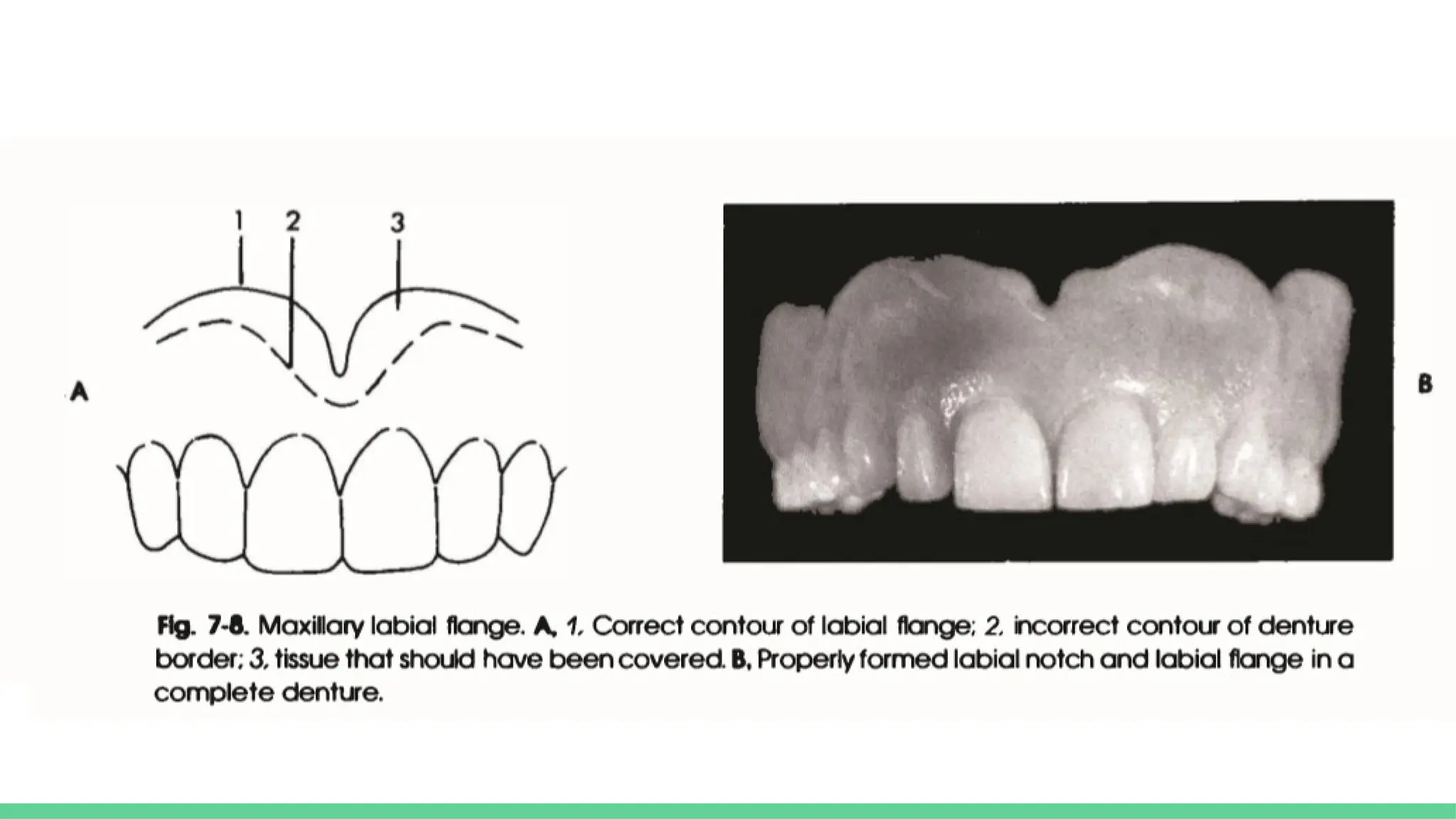 Anatomical landmarks of maxilla and mandible.pptx