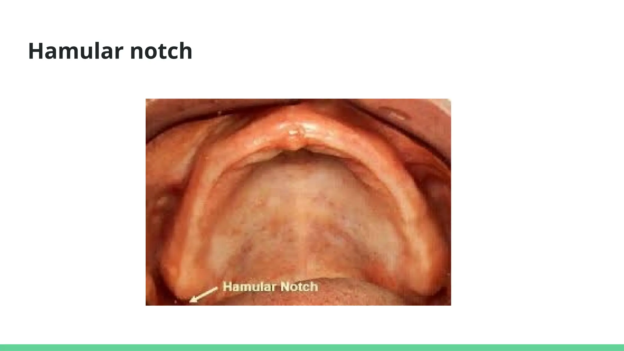 Anatomical landmarks of maxilla and mandible.pptx