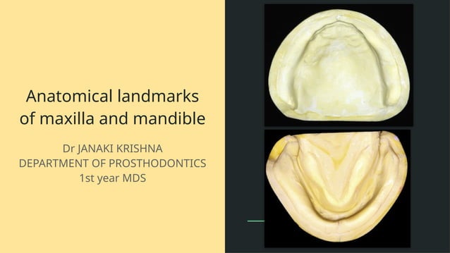 Anatomical landmarks of maxilla and mandible.pptx