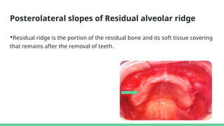 Anatomical landmarks of maxilla and mandible.pptx