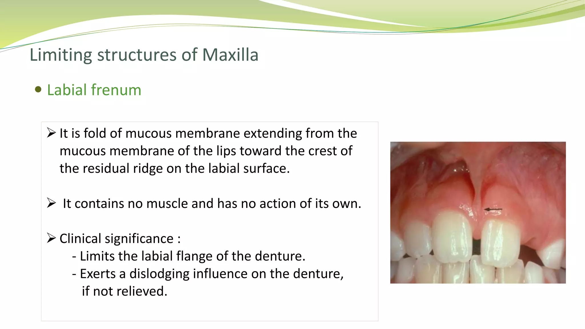 Anatomical landmarks of maxilla and mandible [autosaved] | PPTX