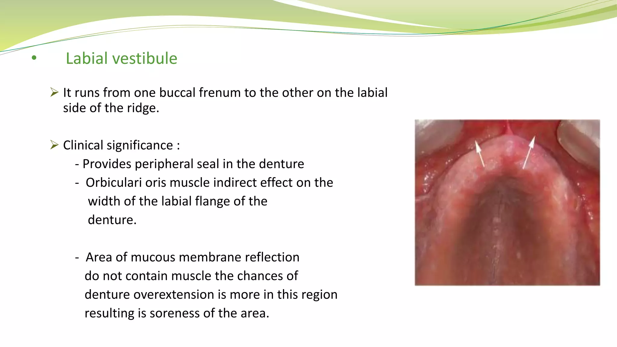 Anatomical landmarks of maxilla and mandible [autosaved] | PPTX