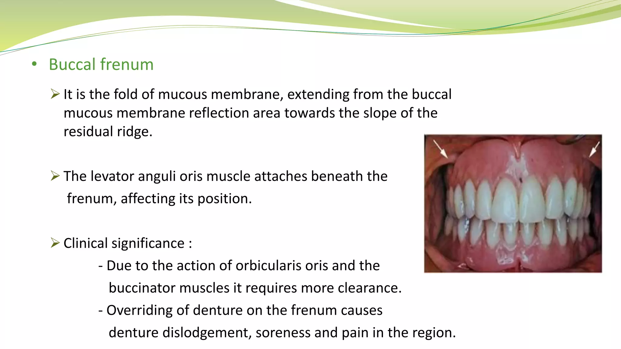 Anatomical landmarks of maxilla and mandible [autosaved] | PPTX