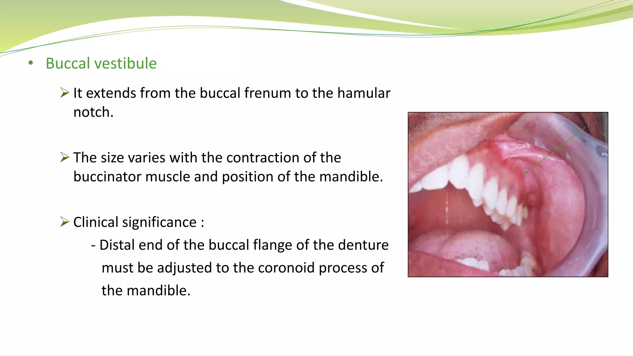 Anatomical landmarks of maxilla and mandible [autosaved] | PPTX