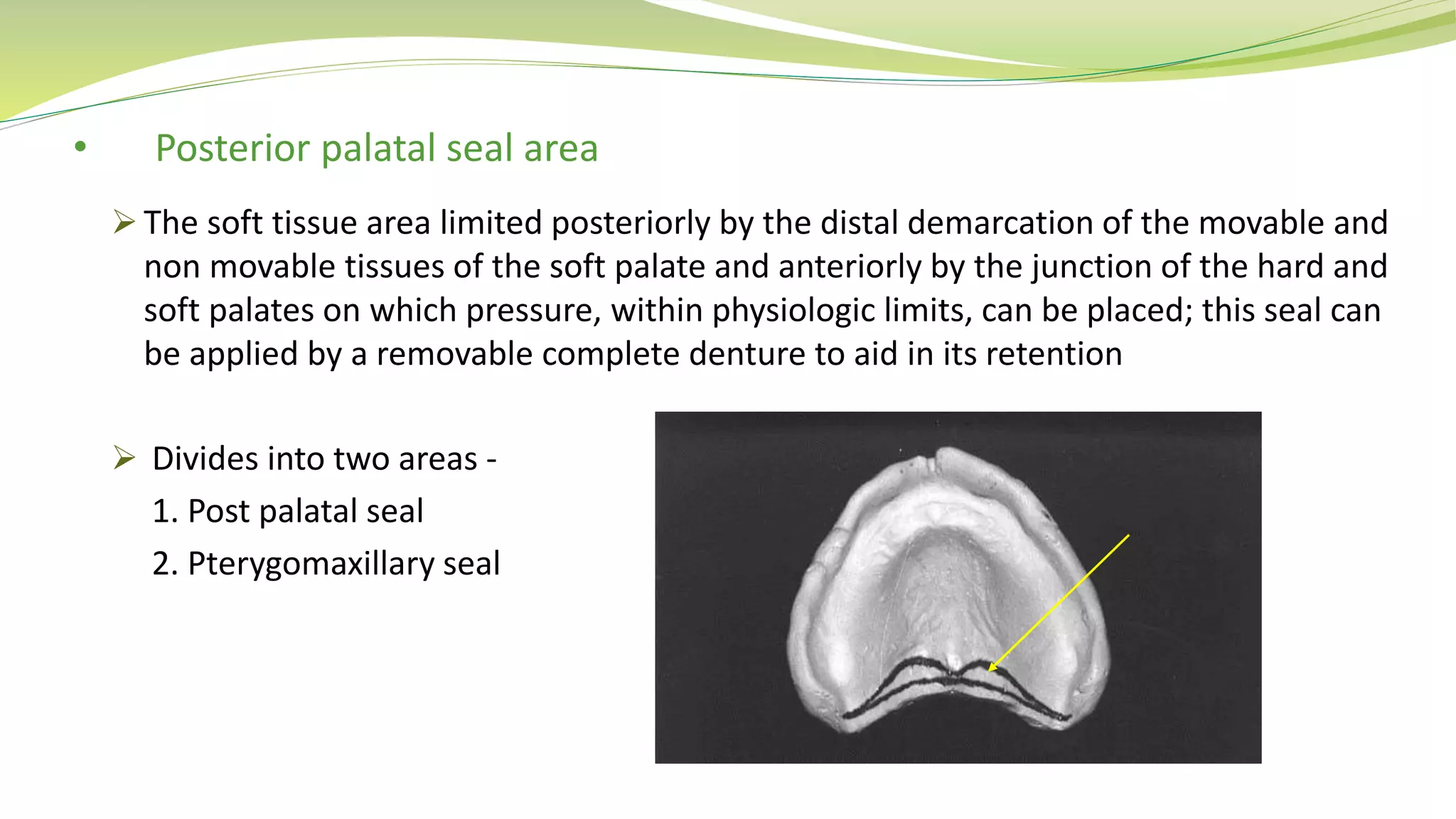 Anatomical landmarks of maxilla and mandible [autosaved] | PPTX