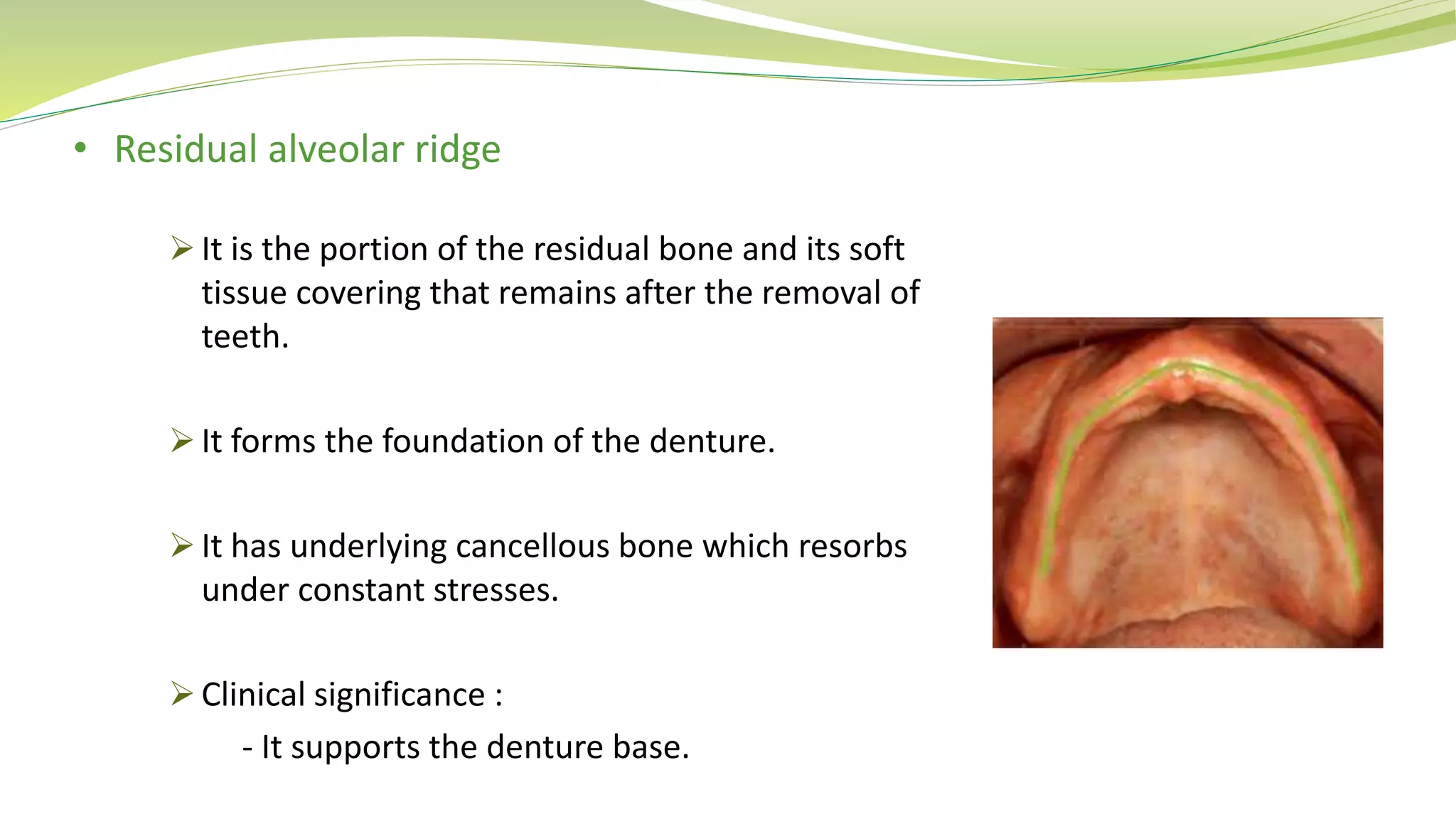 Anatomical landmarks of maxilla and mandible [autosaved] | PPTX