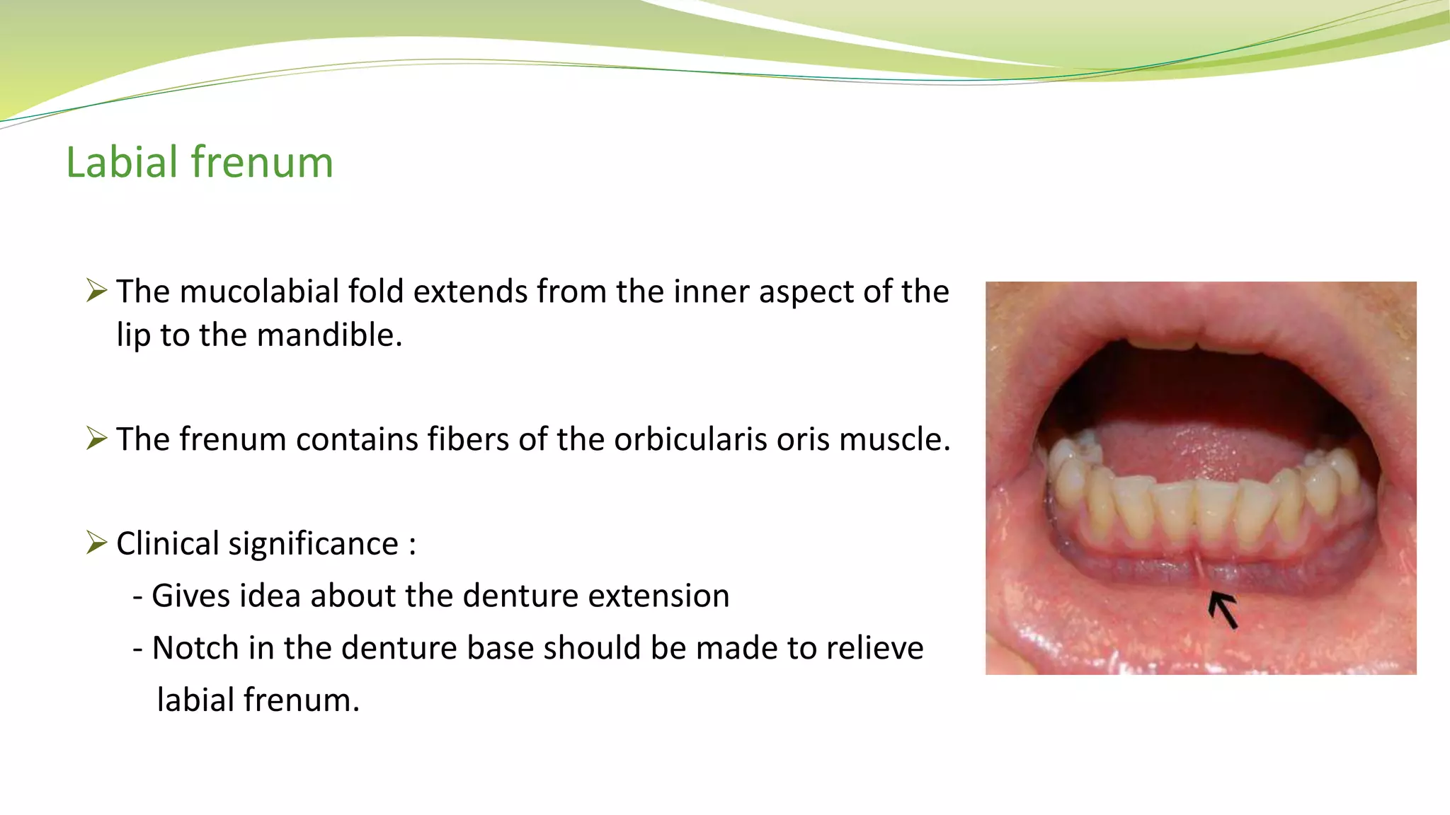 Anatomical landmarks of maxilla and mandible [autosaved] | PPTX