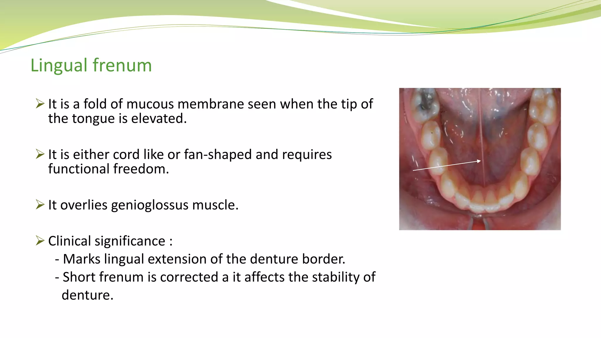 Anatomical landmarks of maxilla and mandible [autosaved] | PPTX