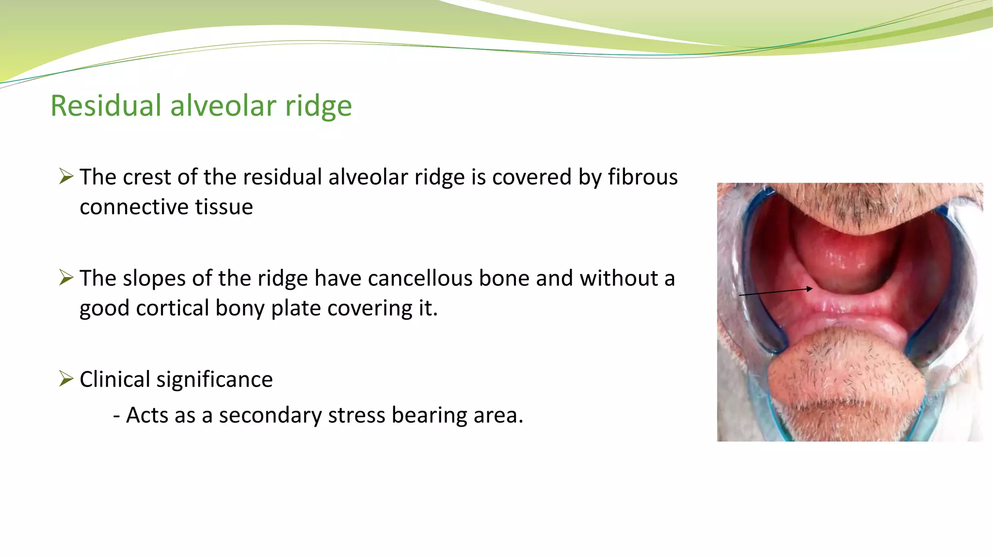 Anatomical landmarks of maxilla and mandible [autosaved] | PPTX