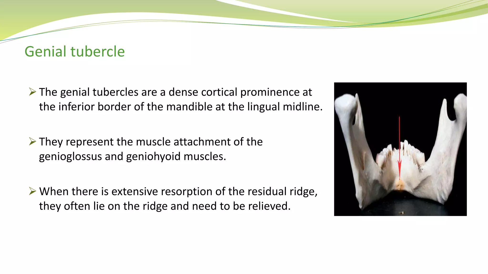 Anatomical landmarks of maxilla and mandible [autosaved] | PPTX