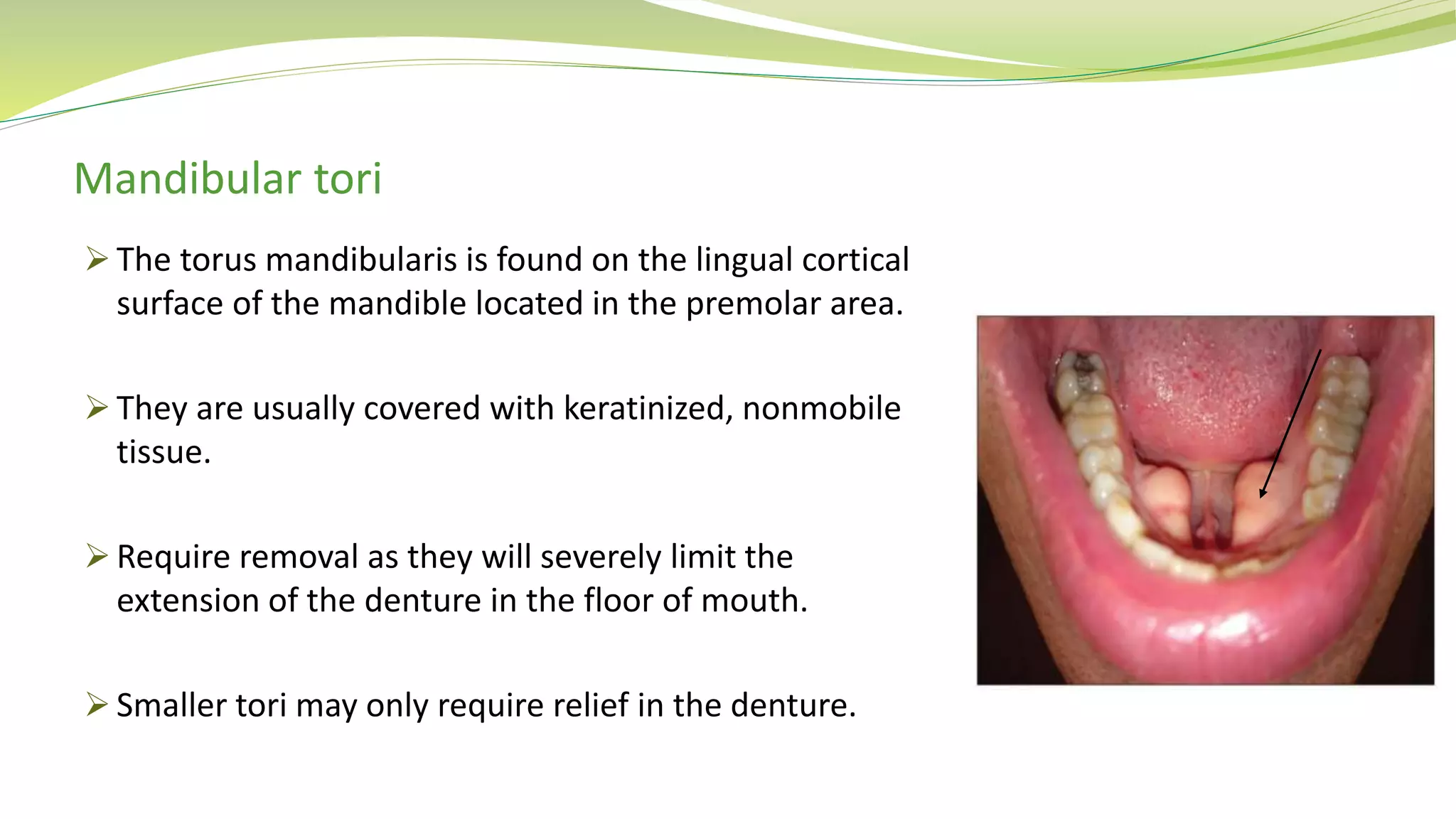Anatomical landmarks of maxilla and mandible [autosaved] | PPTX