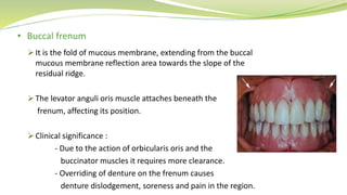 Anatomical landmarks of maxilla and mandible [autosaved] | PPTX