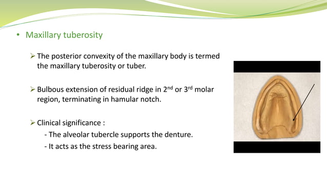 Anatomical landmarks of maxilla and mandible [autosaved] | PPTX | Ear ...