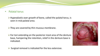 Anatomical landmarks of maxilla and mandible [autosaved] | PPTX