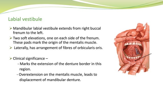 Anatomical landmarks of maxilla and mandible [autosaved] | PPTX | Ear ...