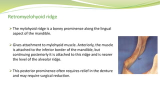 Anatomical landmarks of maxilla and mandible [autosaved] | PPTX