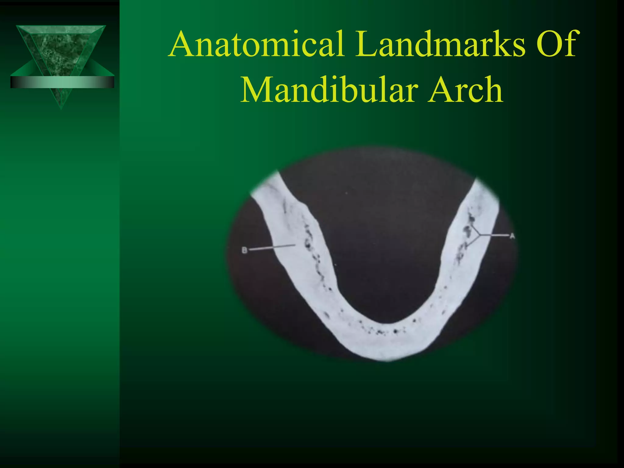 Anatomical Landmarks Of Maxillary And Mandibular Arch.ppt