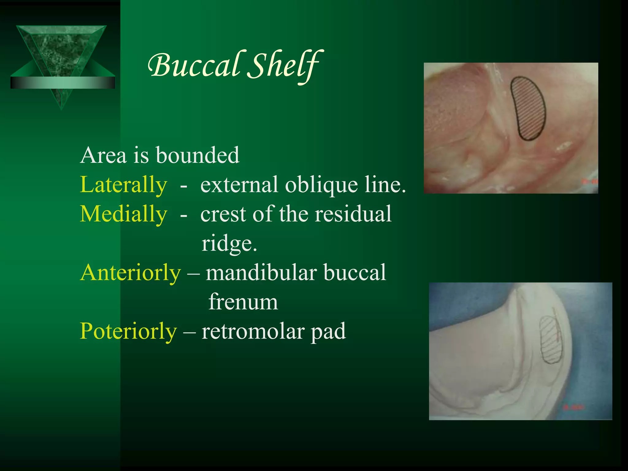 Anatomical Landmarks Of Maxillary And Mandibular Arch.ppt