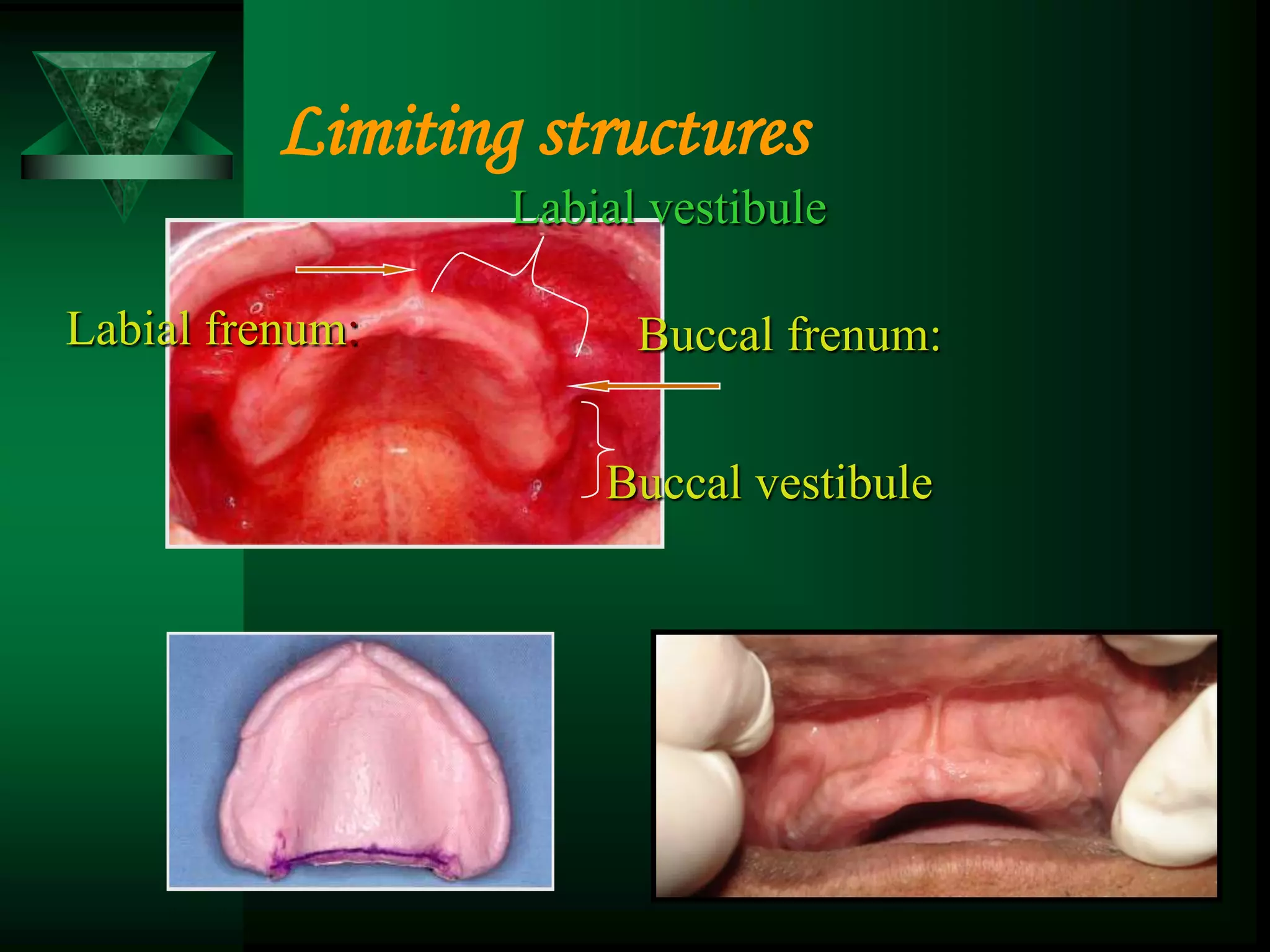 Anatomical Landmarks Of Maxillary And Mandibular Arch.ppt