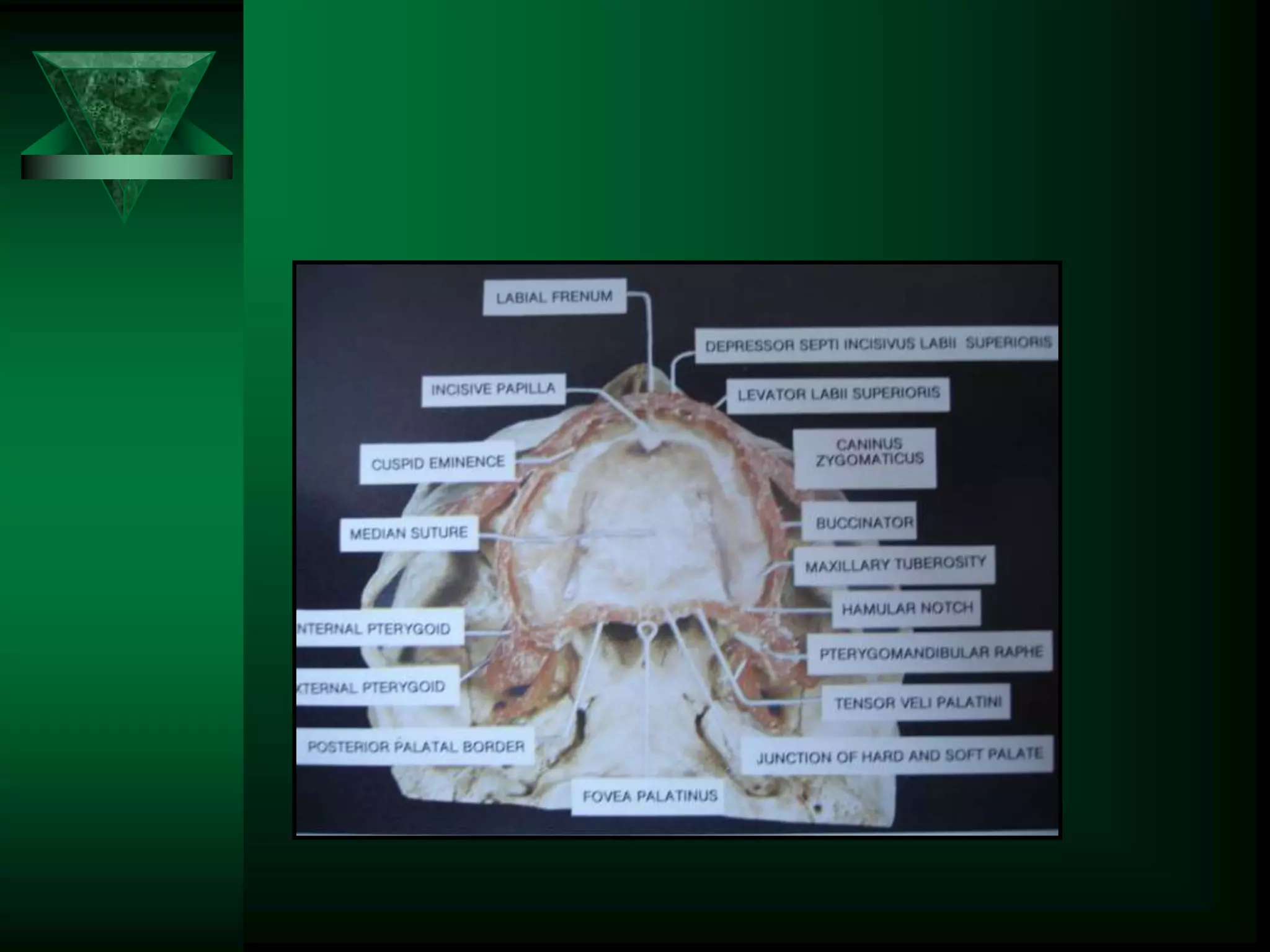 Anatomical Landmarks Of Maxillary And Mandibular Arch.ppt