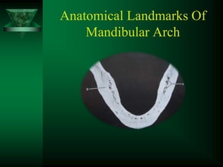 Anatomical Landmarks Of Maxillary And Mandibular Arch.ppt