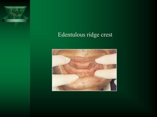 Anatomical Landmarks Of Maxillary And Mandibular Arch.ppt