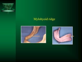 Anatomical Landmarks Of Maxillary And Mandibular Arch.ppt
