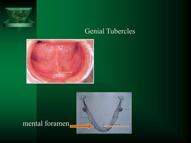 Anatomical Landmarks Of Maxillary And Mandibular Arch.ppt