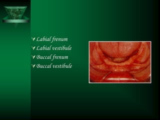 Anatomical Landmarks Of Maxillary And Mandibular Arch.ppt