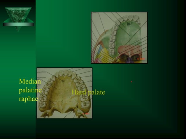 Anatomical Landmarks Of Maxillary And Mandibular Arch.ppt
