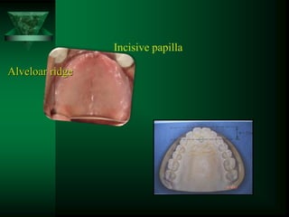 Anatomical Landmarks Of Maxillary And Mandibular Arch.ppt