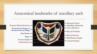 Anatomical landmarks of maxillary arch.pptx